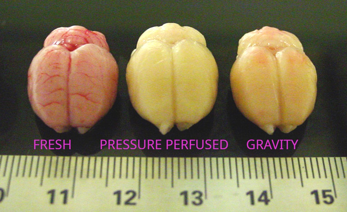 Perfusion Three™ Pressure Fixation System